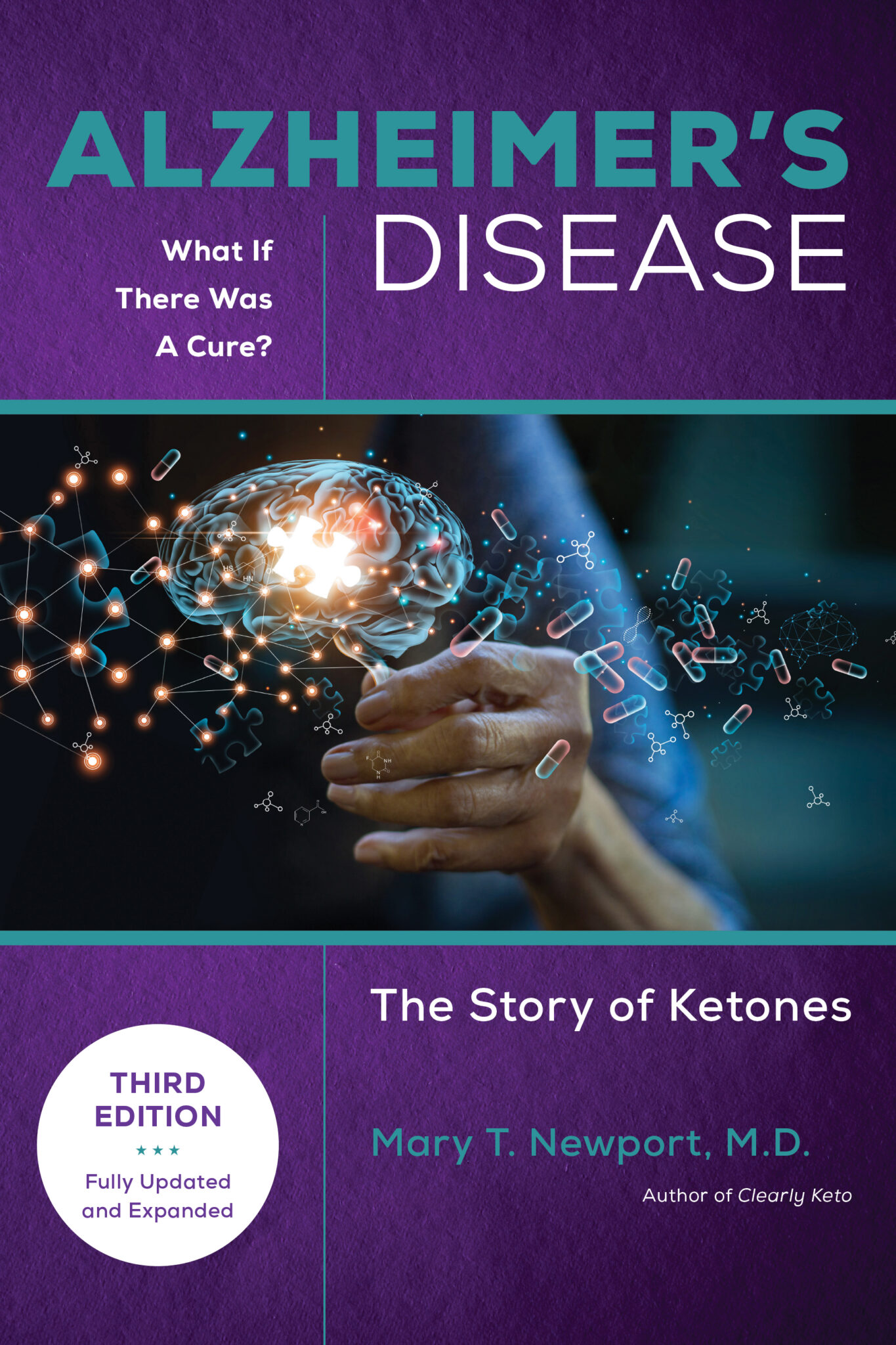 Coconut Oil and Ketones for Brain Health & Alzheimer's